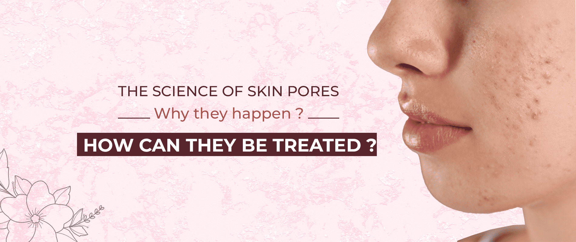 The Science of Skin Pores: Why they happen & how can they be treated ...